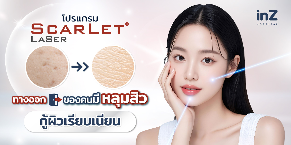 โปรแกรม Scarlet Laser ทางออกของคนมีหลุมสิว กู้ผิวเรียบเนียน